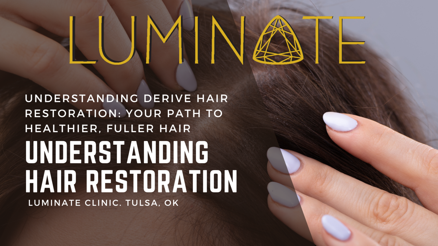 Understanding Derive Hair Restoration - Luminate Clinic