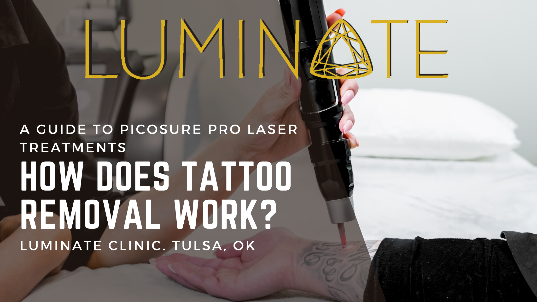 How Does Tattoo Removal Work? A Guide to PicoSure Pro Laser Treatments - Luminate Clinic